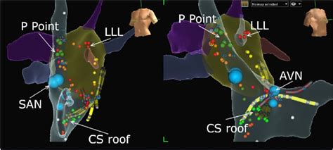 Three Dimensional Electroanatomical Mapping For Biatrial Applications Download Scientific