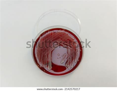 Mrsa Staphylococcus Aureus Grampositive Gramvariable Nonmotile Foto Stock 2142570217 Shutterstock