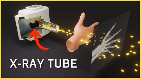 How An X Ray Tube Works⚡how X Rays Are Generated Youtube