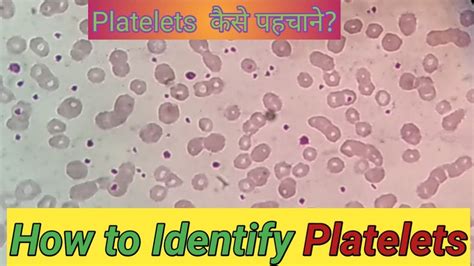 Platelet Count