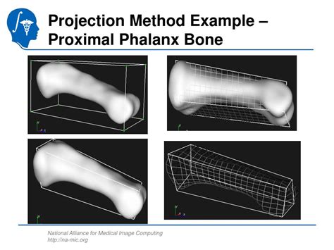 Ppt Towards Automating Patient Specific Finite Element Model Development Powerpoint