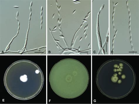Sarocladium Sasijaorum Cbs 147213 A C Conidiophores And Conidia D