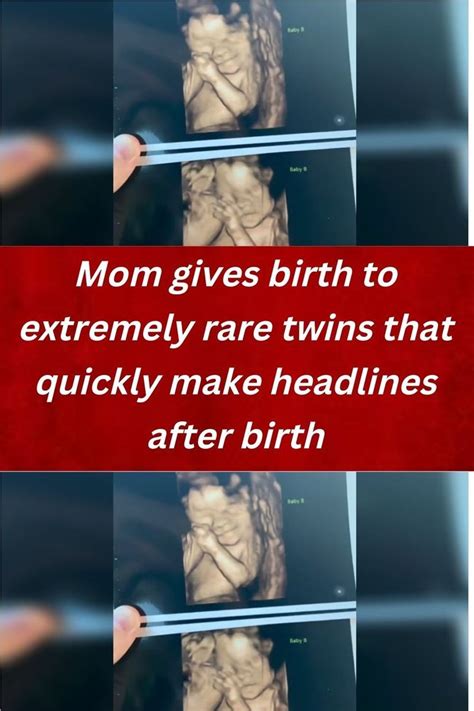 Mom Gives Birth To Extremely Rare Twins That Quickly Make Headlines