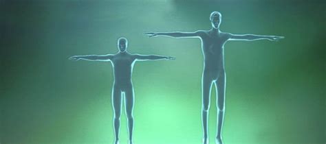 متلازمة مارفان Marfan Syndrome، السبب والأعراض وطرق العلاج