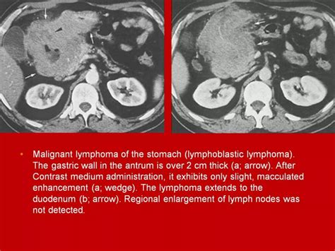 Whole Body Computed Tomography Git Pptx Obscenity And Profanity Sensitive Topics