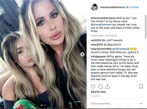 Et Tu Kroy Kim Zolciak Biermanns Husband Gets Botox Injection