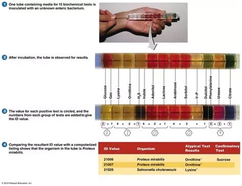 Biochemical Identification Of Microorganisms