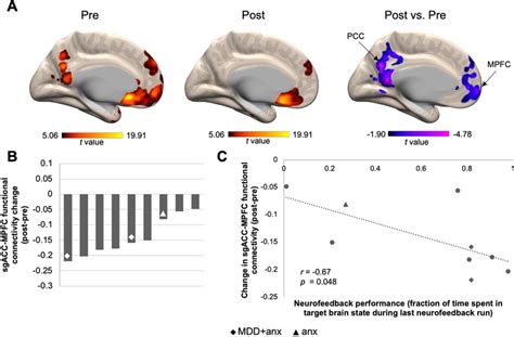 One Session Of MbNF Reduced DMN Functional Connectivity A A T Test
