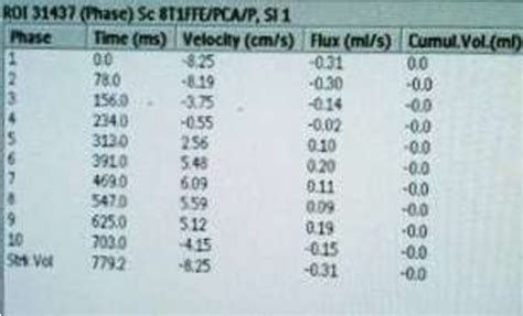 Figure 1 From Diagnostic Value Of Mri Csf Flowmetry For The Diagnosis Of Normal Pressure
