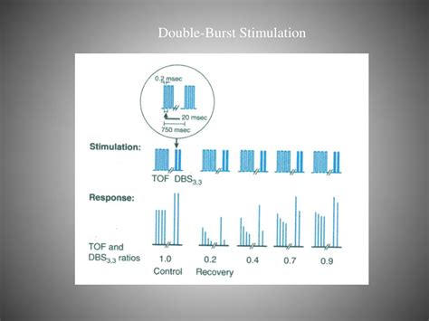 Ppt Neuromuscular Monitoring Powerpoint Presentation Free Download