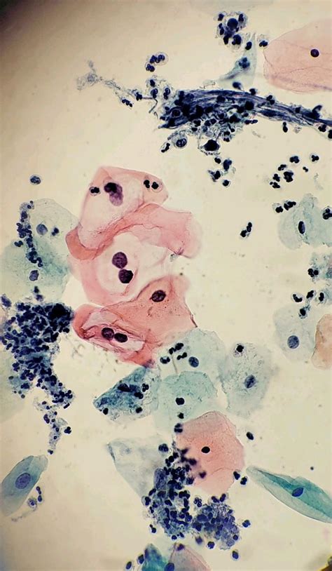 Emily Krzyminski Mba Fache Posted On Linkedin