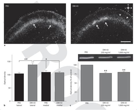 Neuroanatomical Modifications In Fiber Clustering In The Superior Download Scientific Diagram