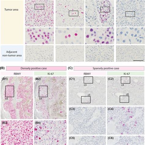 Differential Expression Of Rna‐binding Motif Y Rbmy In Male Download Scientific Diagram
