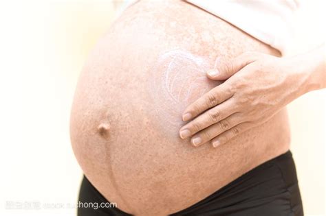 孕妇肚子痒是怎么回事孕妇肚皮痒怎么缓解 随意云