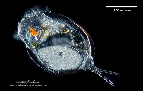 Rotifer Under A Microscope