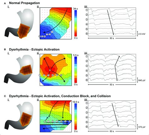 Examples Of High Resolution Mapping Of In Vivo Gastric Slow Waves Download Scientific