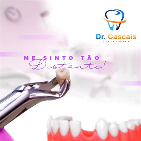 Dr Cascais Perdeu Um Ou Mais Dentes