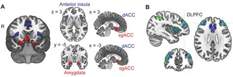 Depression Core Network Based Individualized Targeting For Transcranial Magnetic Stimulation