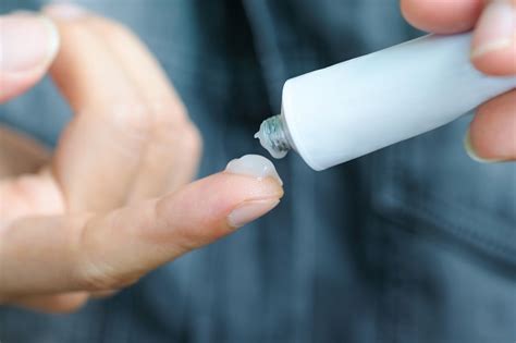 Sindrom Cushing Akibat Penggunaan Steroid Topikal Alomedika
