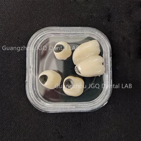 China Dental Lab Pfm Metal Crown Bridge Porcelain Fused To Metal Tooth