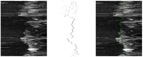 deep learning for boundary detection in model based segmentation hans