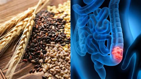 Este Es El Superalimento Que Ayuda A Prevenir El Cáncer De Colon Y El