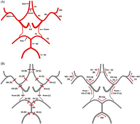 Anterior Cerebral Artery