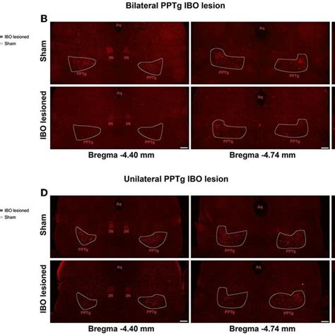 Figure E Quantification Of Cholinergic Neurons And Lesion Analysis In