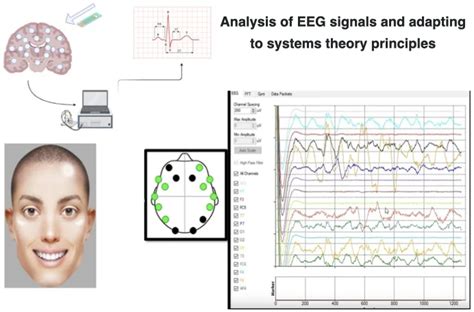 Electroencephalography Eeg Data Showing Onset Of An Epileptic Seizure