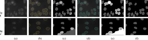 Figure 1 From Cell Nuclei Segmentation In Fluorescence Microscopy Images Using Inter And Intra