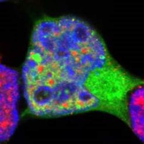 Las Vacunas Del Futuro Podrían Administrarse A Través De Nanocápsulas