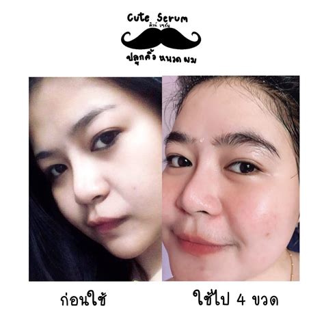 ดกสุดในย่ เซรั่มคิ้วดก หนวด ไรผม มีบริการเก็บเงินปลายทาง