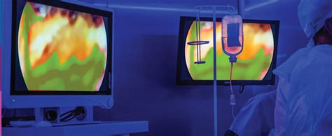 Laparoscopic Fluorescence Imaging Enhancing Surgical Visualization And