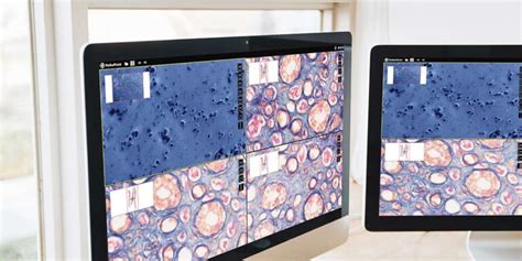 What Is Z Stacking Technique In Digital Pathology