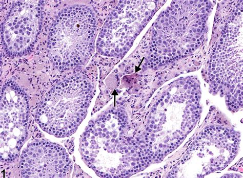 Interstitial Cells Male Reproduction Male Reproductive The Histology