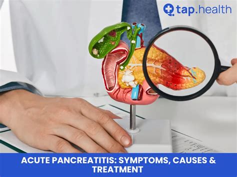 Acute Pancreatitis Symptoms Causes And Treatment