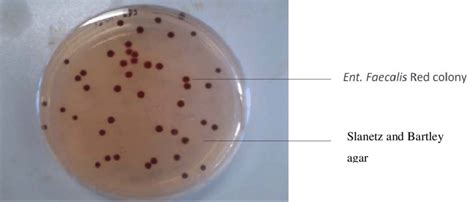 27 Colonies Of E Faecalis On Slanetz And Bartley Agar Media Download
