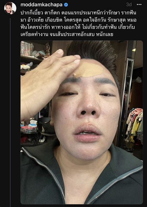 ไม่ยอมทิ้งงาน มดดำ คชาภา อัปเดตอาการปากเบี้ยว ยอมรักษาทุกทาง