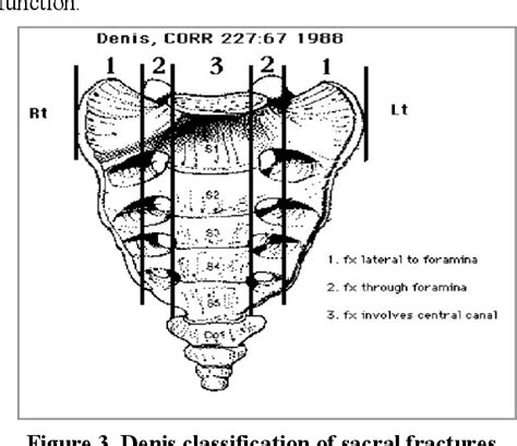Figure 2 From A Narrow Escape High Energy Comminuted Fractures Of