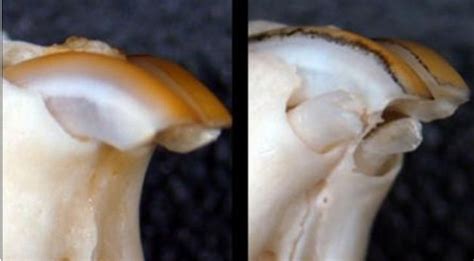 Science Has Found A Way To Fully Regrow Broken Teeth