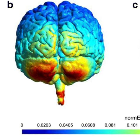Transcranial Direction Current Stimulation TDCS Simulation Software