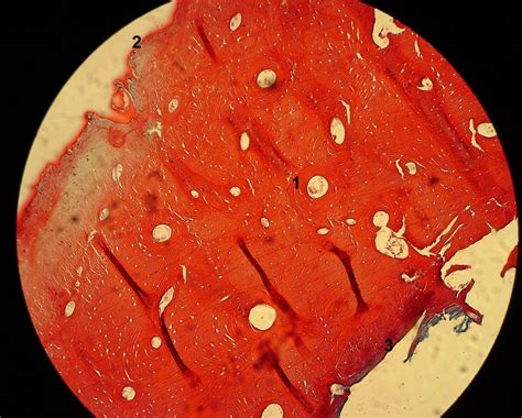 Histologia Ufjf Tecido Ósseo Osso Compacto