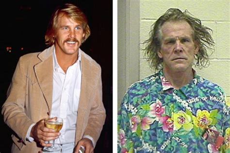 12 Famosos Que Se Arruinaron La Cara Con Desastrosas Operaciones De