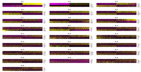GitHub Shivani ScRNA Seq