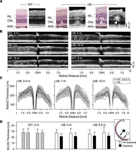 Oct Analysis Of The Retinal Abnormalities In Rd8 Mice A Histologic Download Scientific