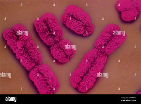 False Colour Scanning Electron Micrograph Sem Of Normal Human Chromosomes Chromosomes Are