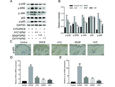 Angelica Yinzi Suppresses The Production Of Inflammatory Cytokines Via