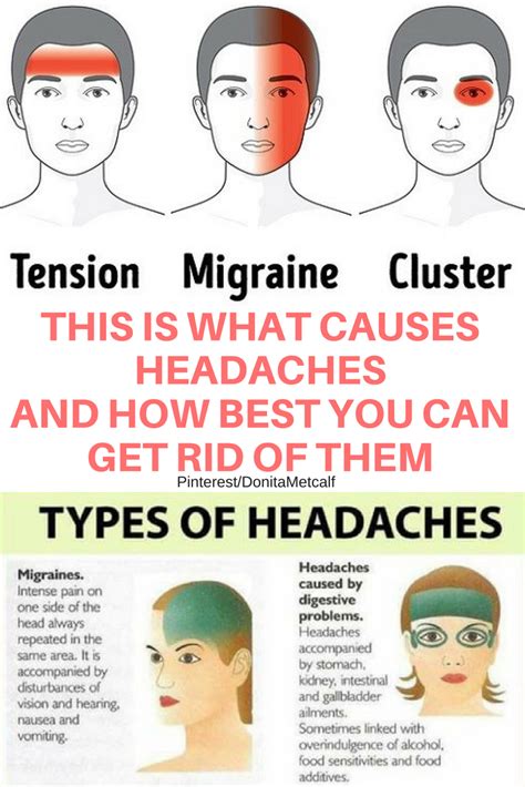 This Is What Causes Headaches And How Best You Can Get Rid Of Them What Causes Headaches