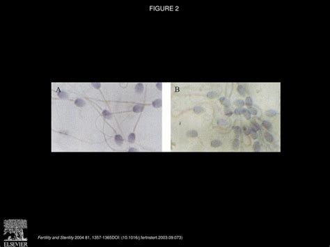 Aranha Clara Ph D Dhananjay D Manjramkar M V Sc Ppt Download