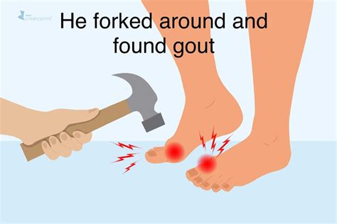 My Uncle Traveled The World Eating Exotic Foods Now Hes Got Hyperuricemia R Puns